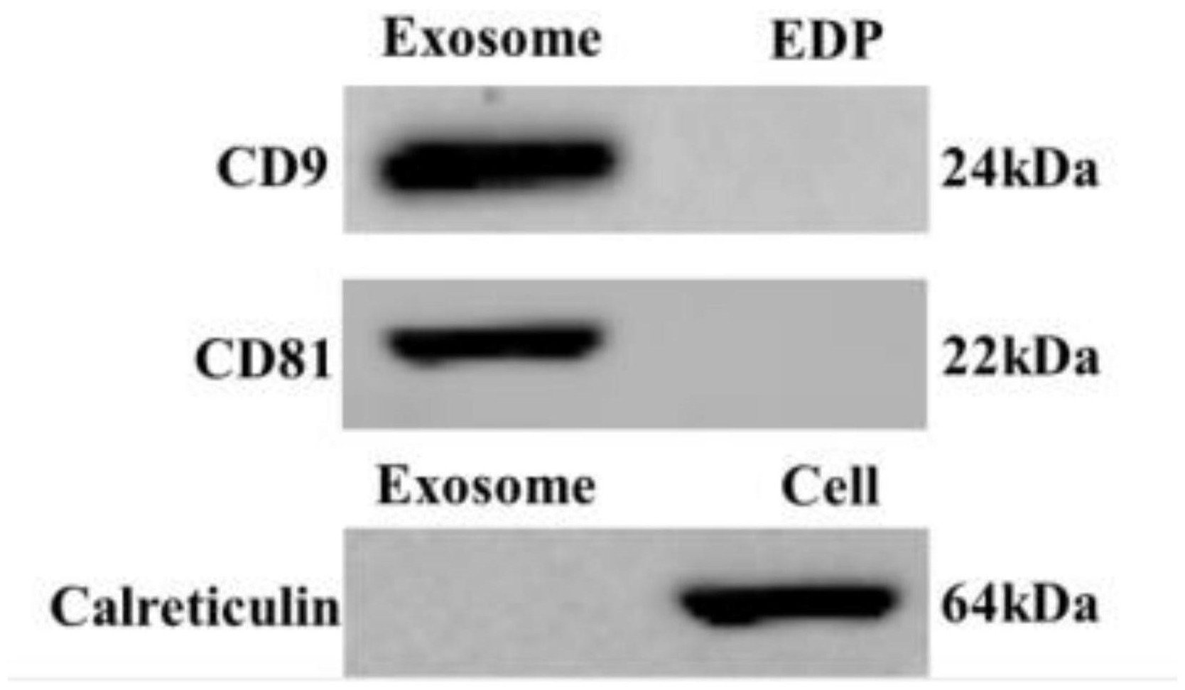 一种完整外泌体分离、纯化试剂盒及检测分析方法_专利查询 - 企查查