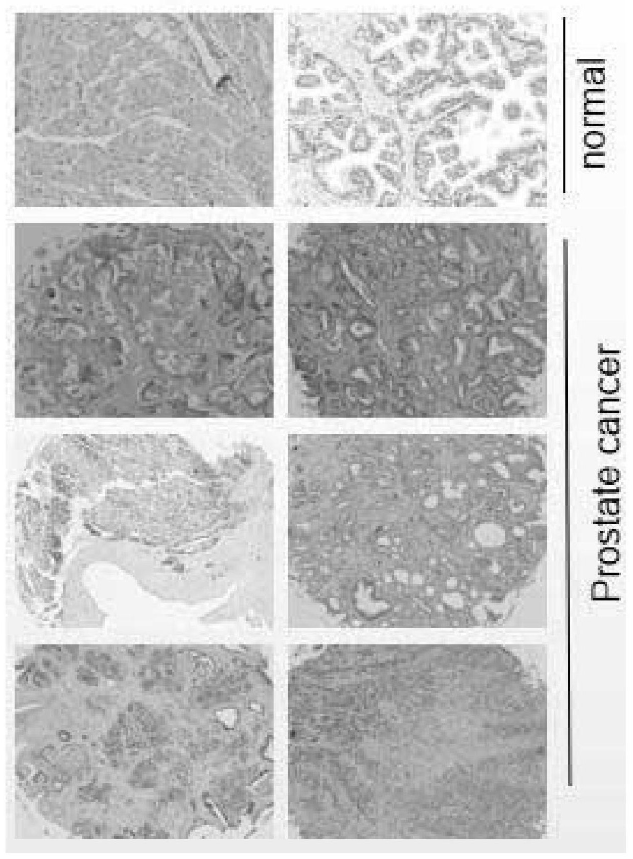 RNA解旋酶DHX33抑制剂在制备用于治疗前列腺癌的药物中的应用_专利查询 - 企查查