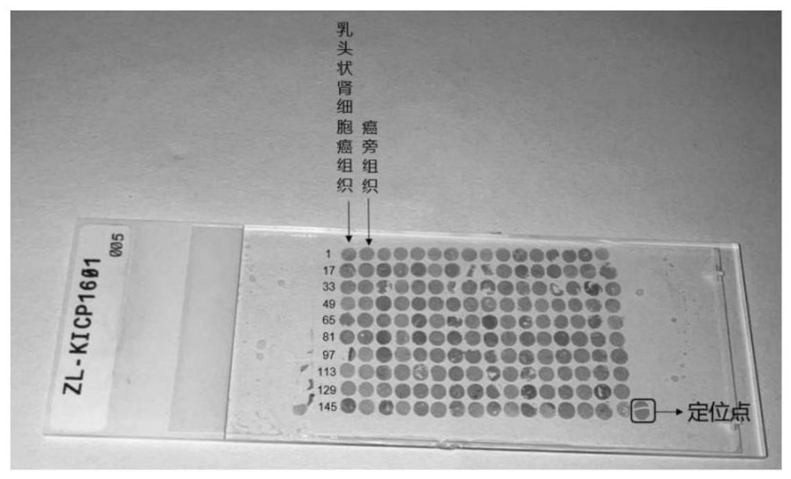DHX33蛋白作为肾癌诊断标志物的应用_专利查询 - 企查查