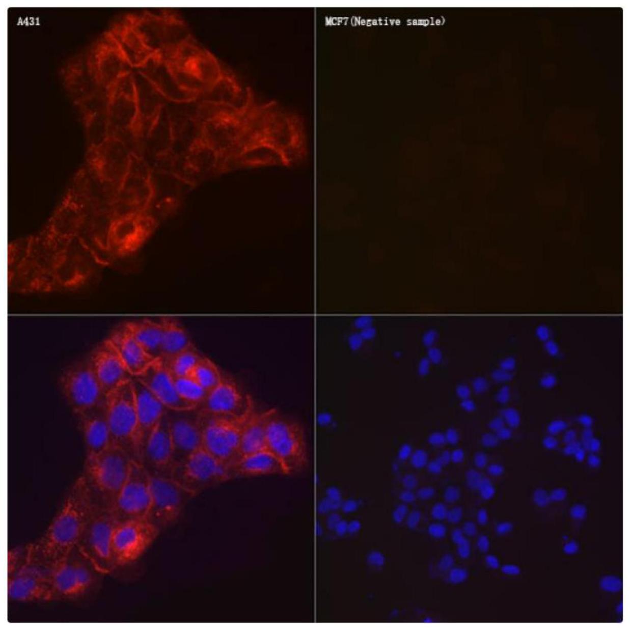 抗人CD142蛋白的兔单克隆抗体及其应用_专利查询 - 企查查
