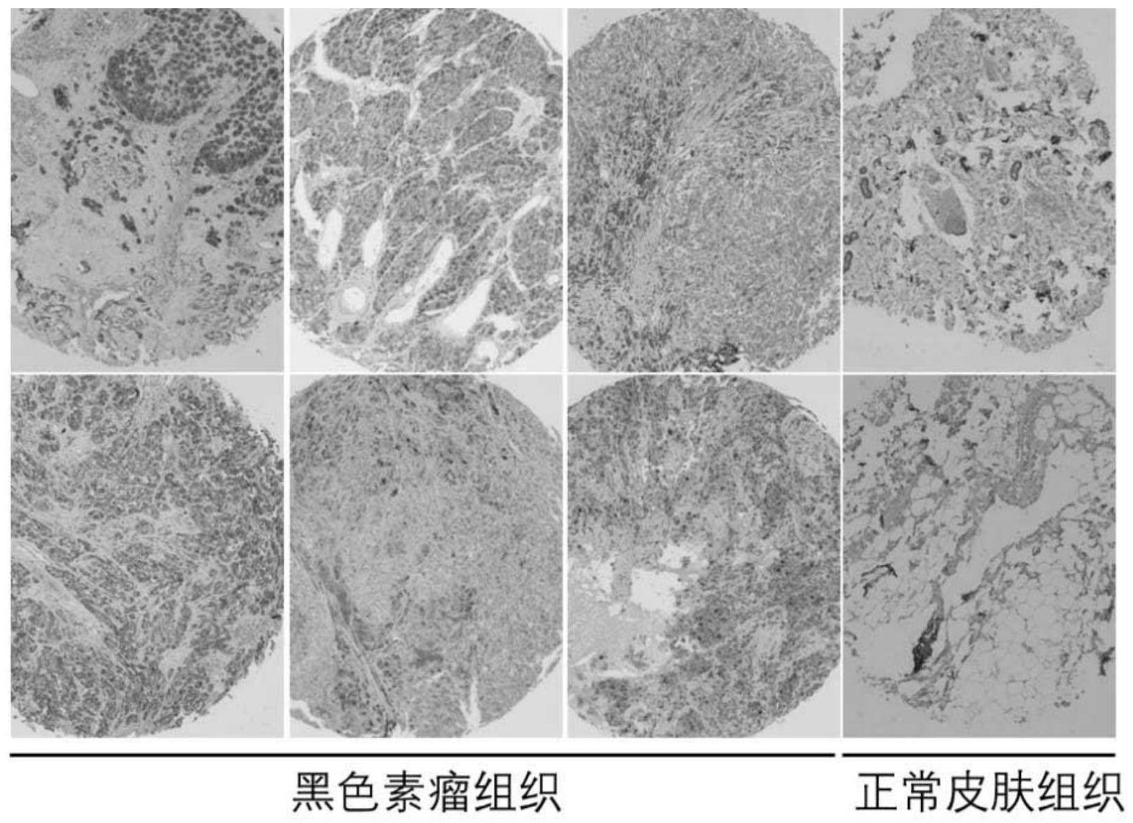 RNA解旋酶DHX33抑制剂在制备用于治疗黑色素瘤的药物中的应用_专利查询 - 企查查