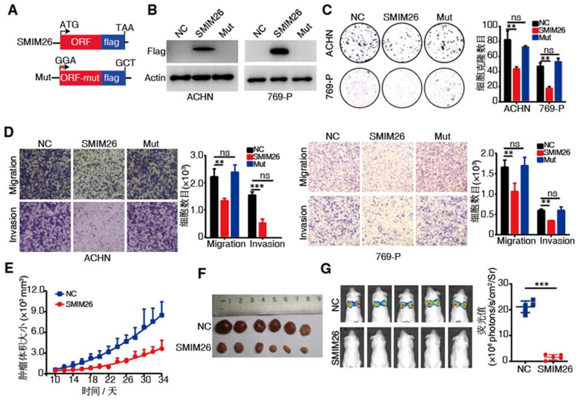 SMIM26蛋白以及SLC25A11蛋白在肾癌中的应用_专利查询 - 企查查